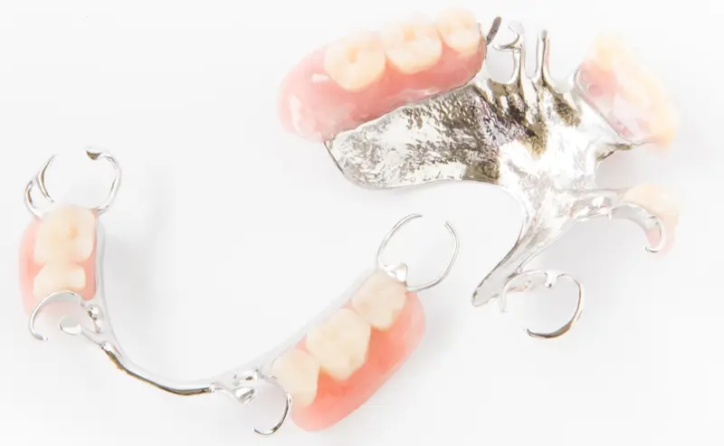 Cast Partial Denture Fabrication