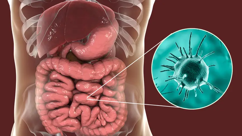 Amebiasis: A Complete Guide to Causes, Symptoms, and Treatment Options