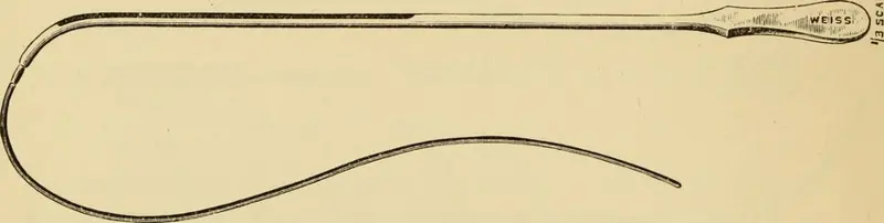 DVIU Urethral Stricture Treatment