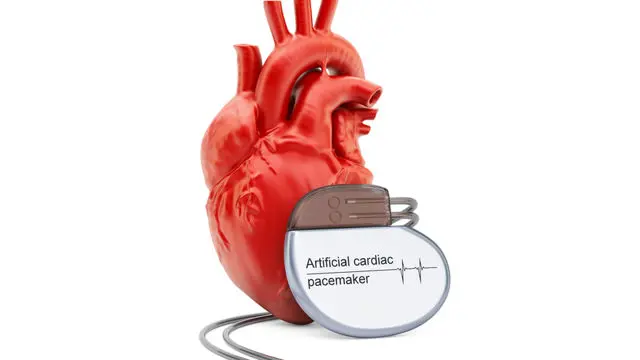 Cardiac Device Implantation Surgery