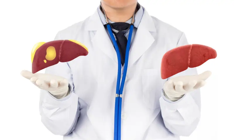 Orthotopic Liver Transplantation (OLT) Surgery