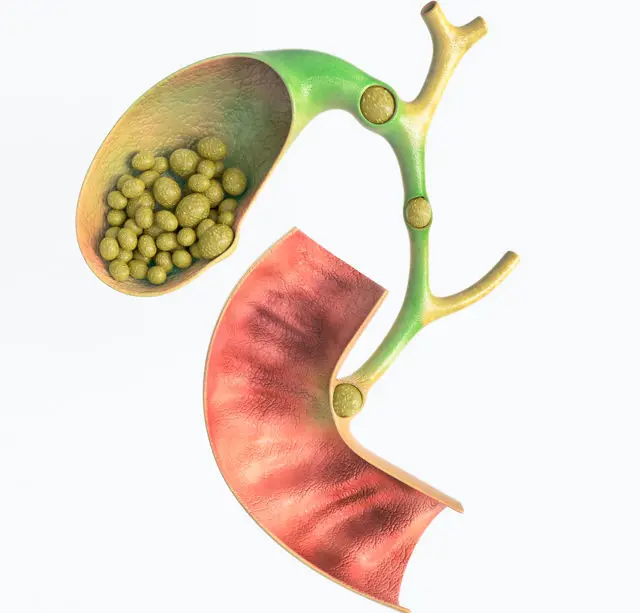 Diagnóstico y Tratamiento de la Colangitis