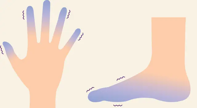 Raynauds Syndrome Explained
