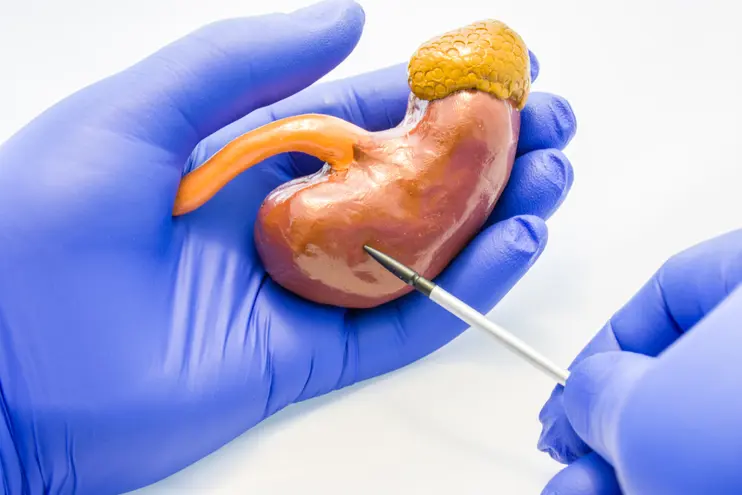 Cirugía de extracción de riñón (Nefrectomía)