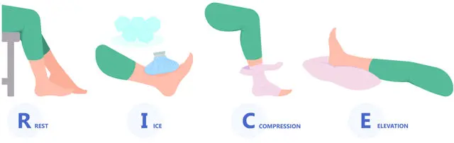 Muscle Strains: Causes, Symptoms, and How to Recover Safely