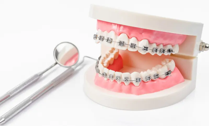 Jaw Deformity Diagnosis and Treatment