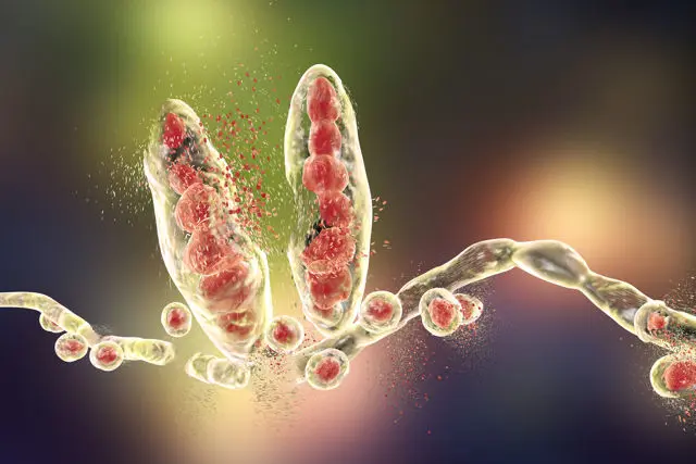 Sphenoiditis Treatment