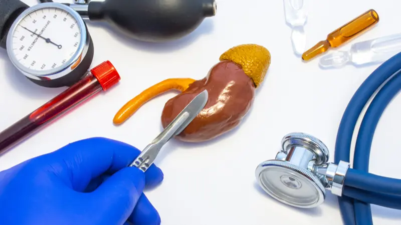 Kidney Removal Surgery (Nephrectomy)