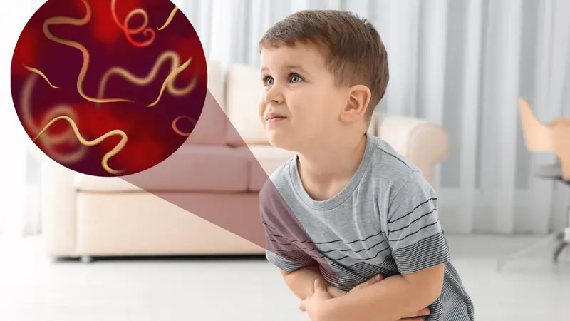 Ascariasis | Symptoms, Causes, Diagnosis & Treatment