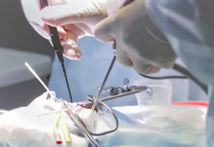 Minimally Invasive Thoracic Surgery 8331