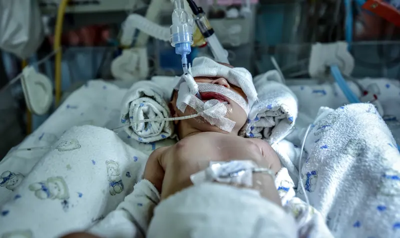 ECMO Life Support Therapy