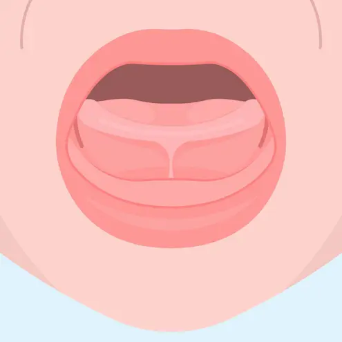 Frenectomy: Benefits, Procedure, and Recovery Explained