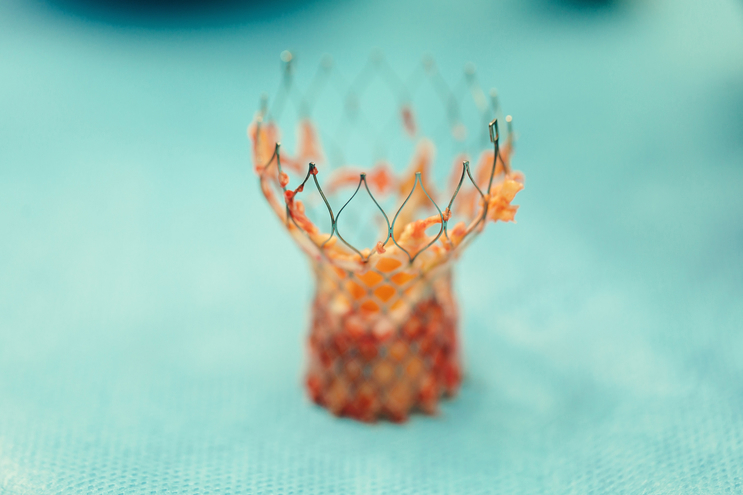 Double Heart Valve Replacement Surgery