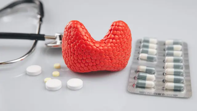 Graves' Disease (Diffuse Toxic Goiter) Treatment