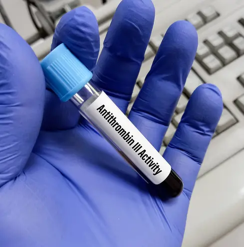 Understanding Antithrombin Deficiency: Symptoms, Causes, and Treatments