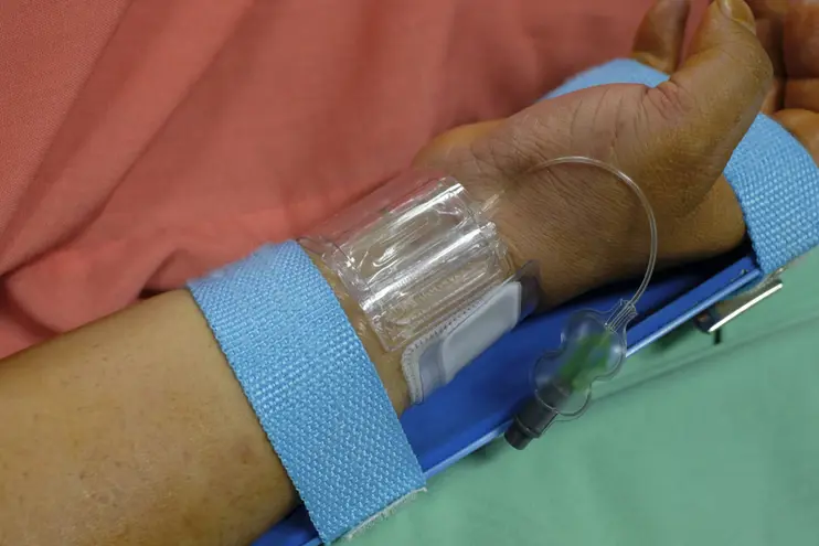 Rotational Atherectomy Procedure