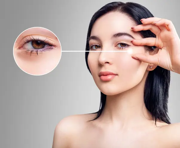 Under-Eye Fat Repositioning Surgery