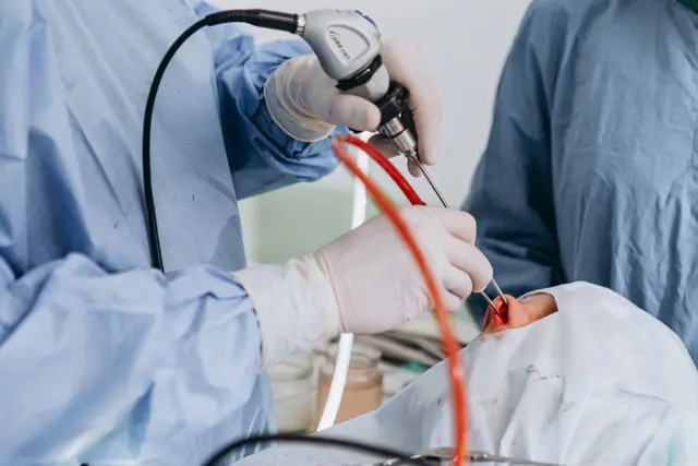 Sphenoiditis Treatment