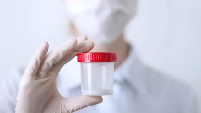 Embryo Storage Services