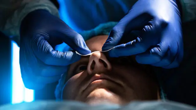 Nasal Wing Reduction Surgery