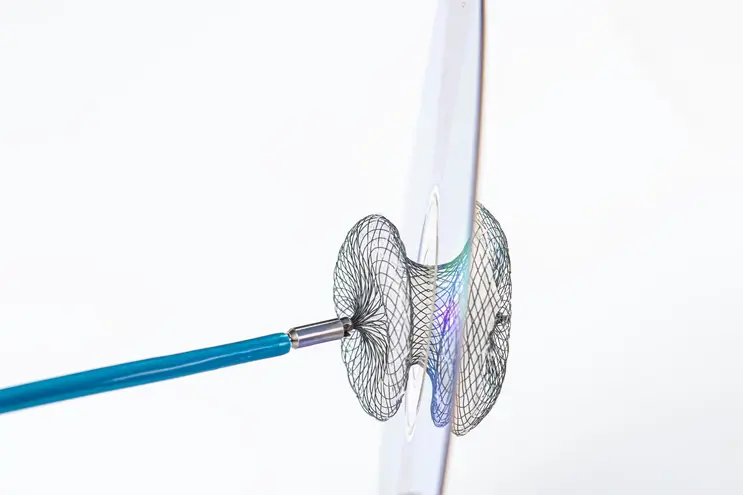 Asd Atrial Septal Defect Repair