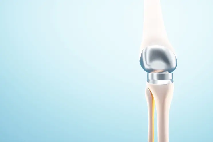 Comprehensive Joint Reconstruction Surgery