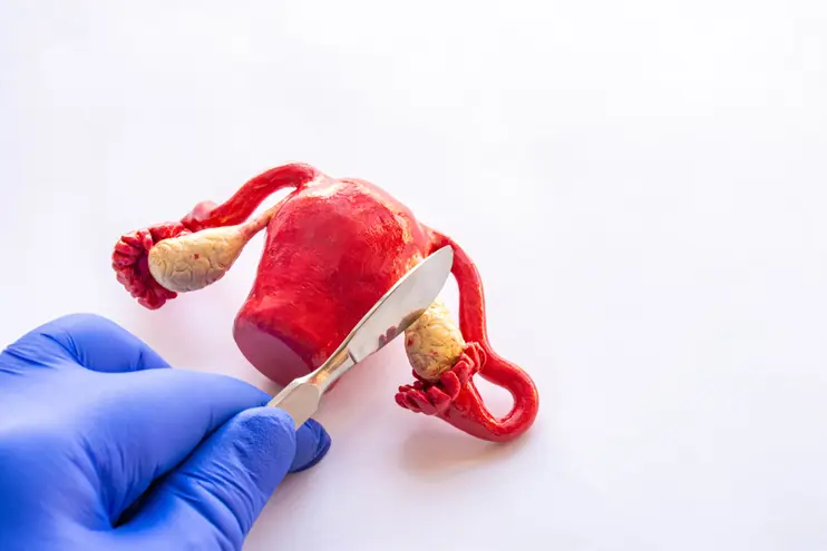 Prophylactic mastectomy