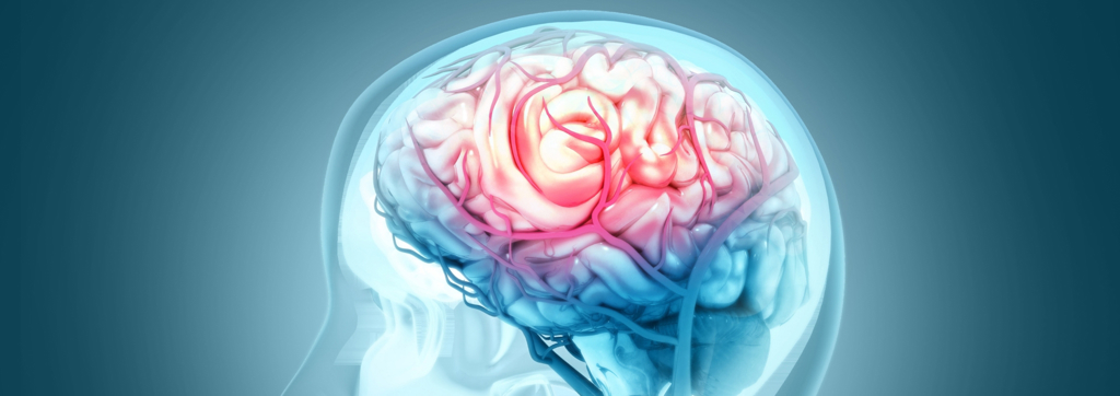 Specialties | Cerebrovascular Diseases