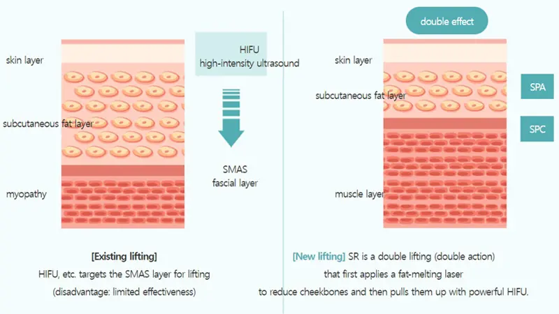 Specialties | Dual Lifting