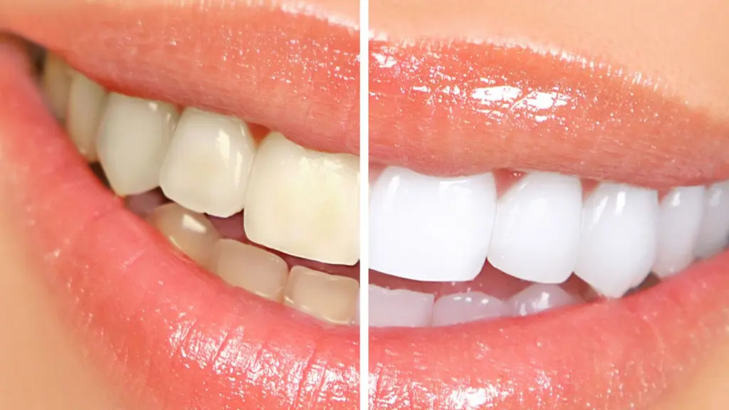 ONE2TEETH Dental Clinic